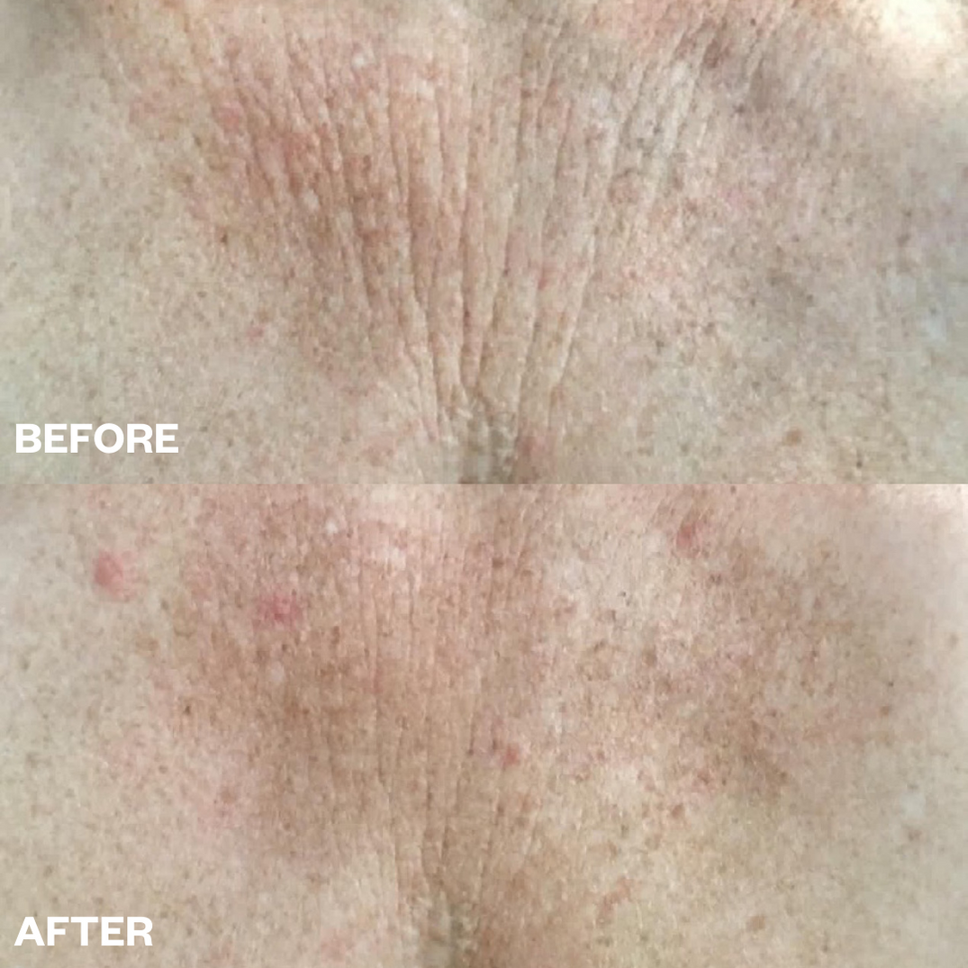 Wrinkles Schminkles™ Chest Wrinkle Patch – Abundance Naturally